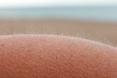 All About Dog Hackles | Great Pet Care