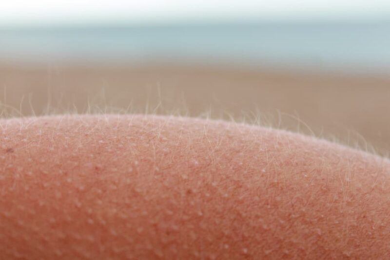 All About Dog Hackles | Great Pet Care