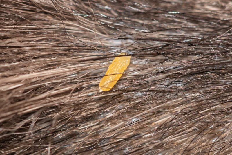 Tapeworms in Dogs | Great Pet Care