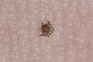 How Long do Ticks Live? Vet Answers and Tips | Great Pet Care